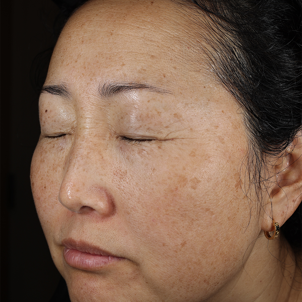 Patients – Avavaskin