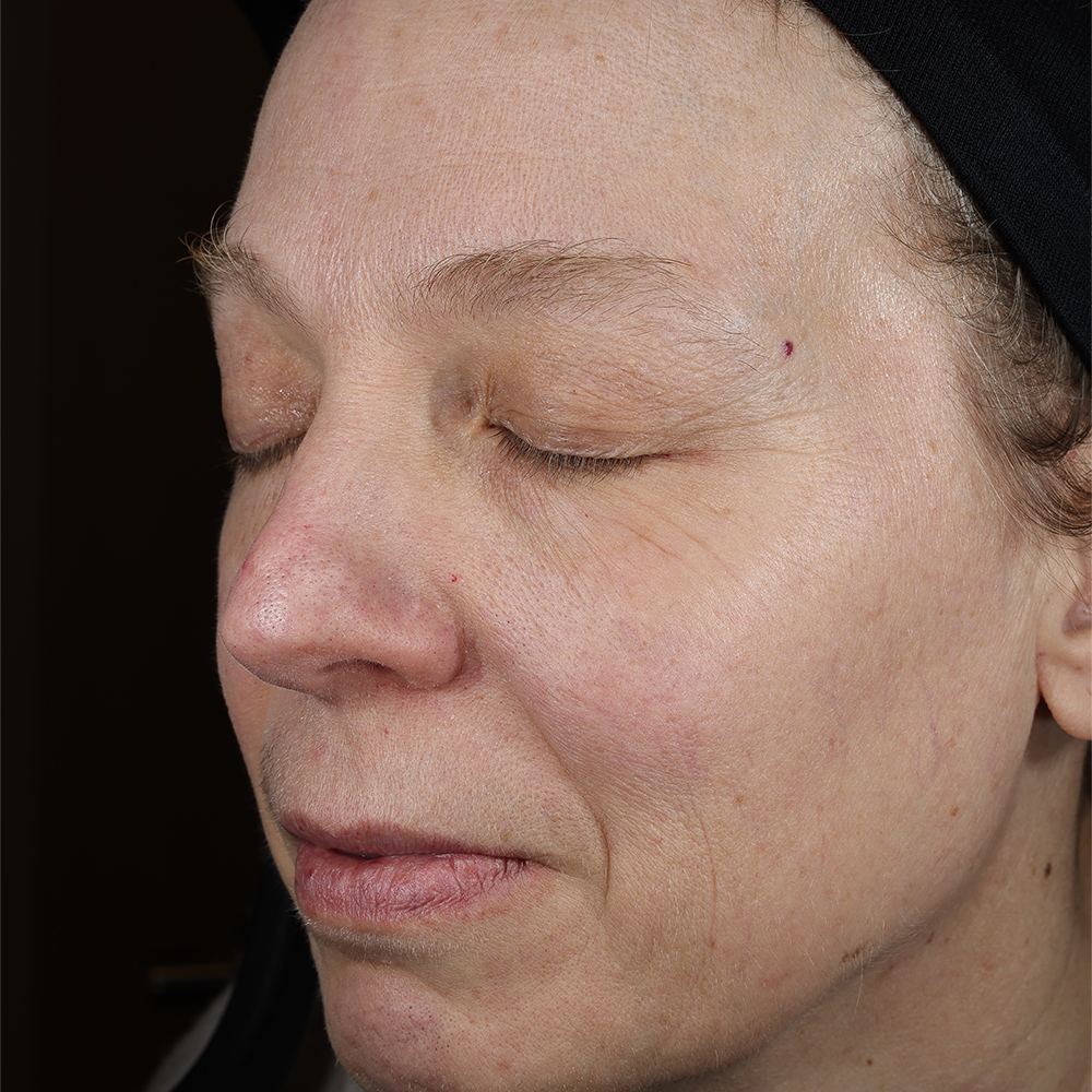 Patients – Avavaskin